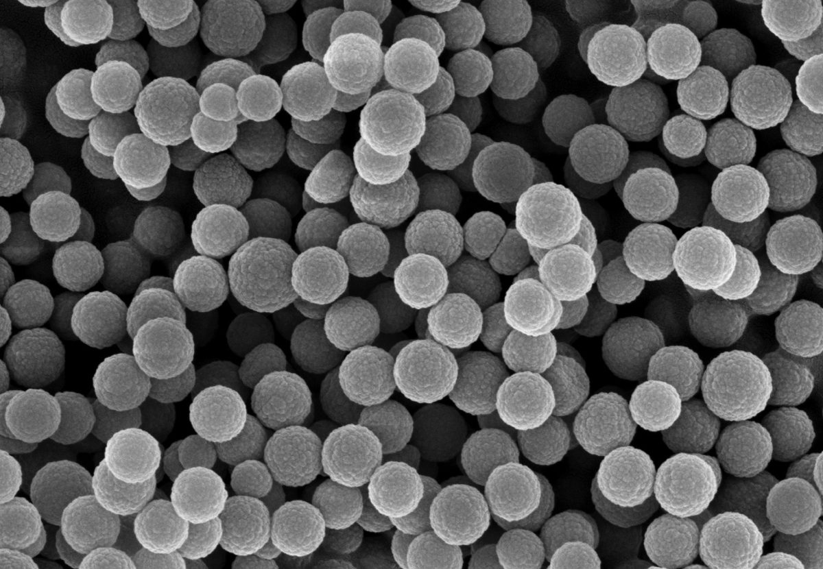 Scanning electron micrograph of tholin… | The Planetary Society